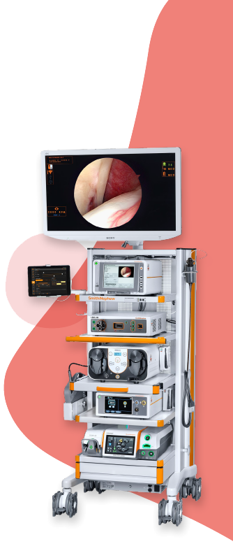Arthroskopischer Turm und Module - Innovative Lösungen für die ...