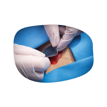 ACTICOAT Antimicrobial Barrier Dressings | Smith+Nephew New Zealand