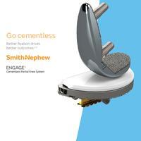 ENGAGE Cementless Partial Knee System | Smith+Nephew Global