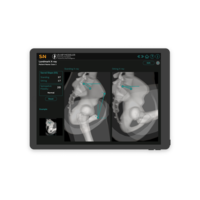 RI.HIP MODELER | Smith+Nephew Global