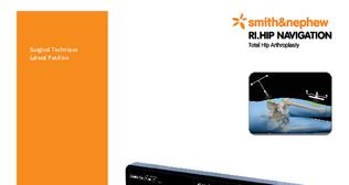 RI.HIP NAVIGATION Total Hip Arthroplasty | Smith+Nephew USA