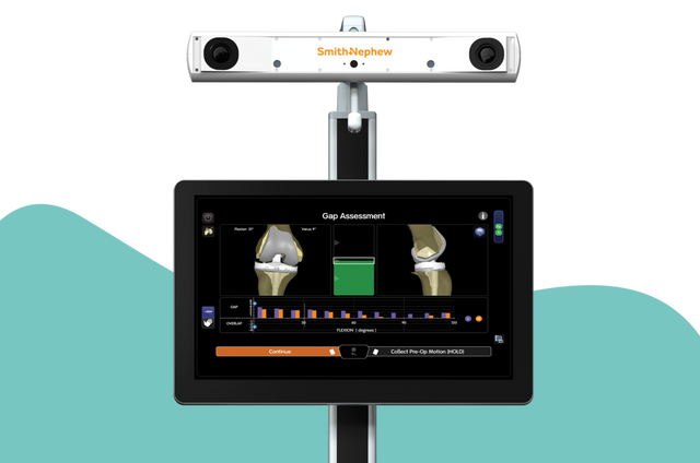 CORI Digital Tensioner for robotic-assisted knee surgery