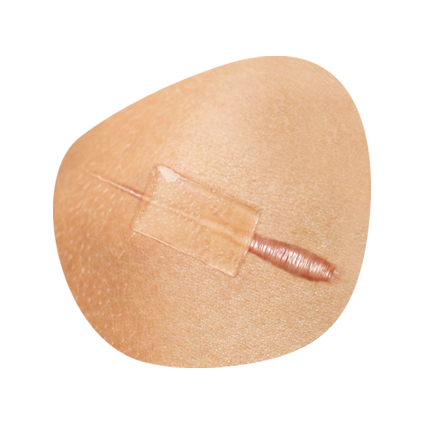 CICA-CARE Global Only